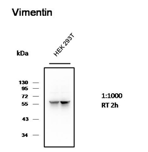 Vimentin Monoclonal Antibody - 广州方源生物科技有限公司官网,BIO-RAD代理,伯乐试剂订购,试剂耗材,仪器 ...