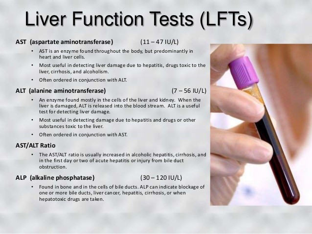 The Meaning Of Alanine Aminotransferase Test In Liver Disease Diagnosis the-meaning-of-alanine-aminotransferase-test-in-liver-disease-diagnosis