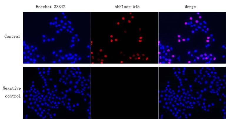 Unleash Precision in Cell Proliferation Analysis: Abbkine KTA2031 EdU ...